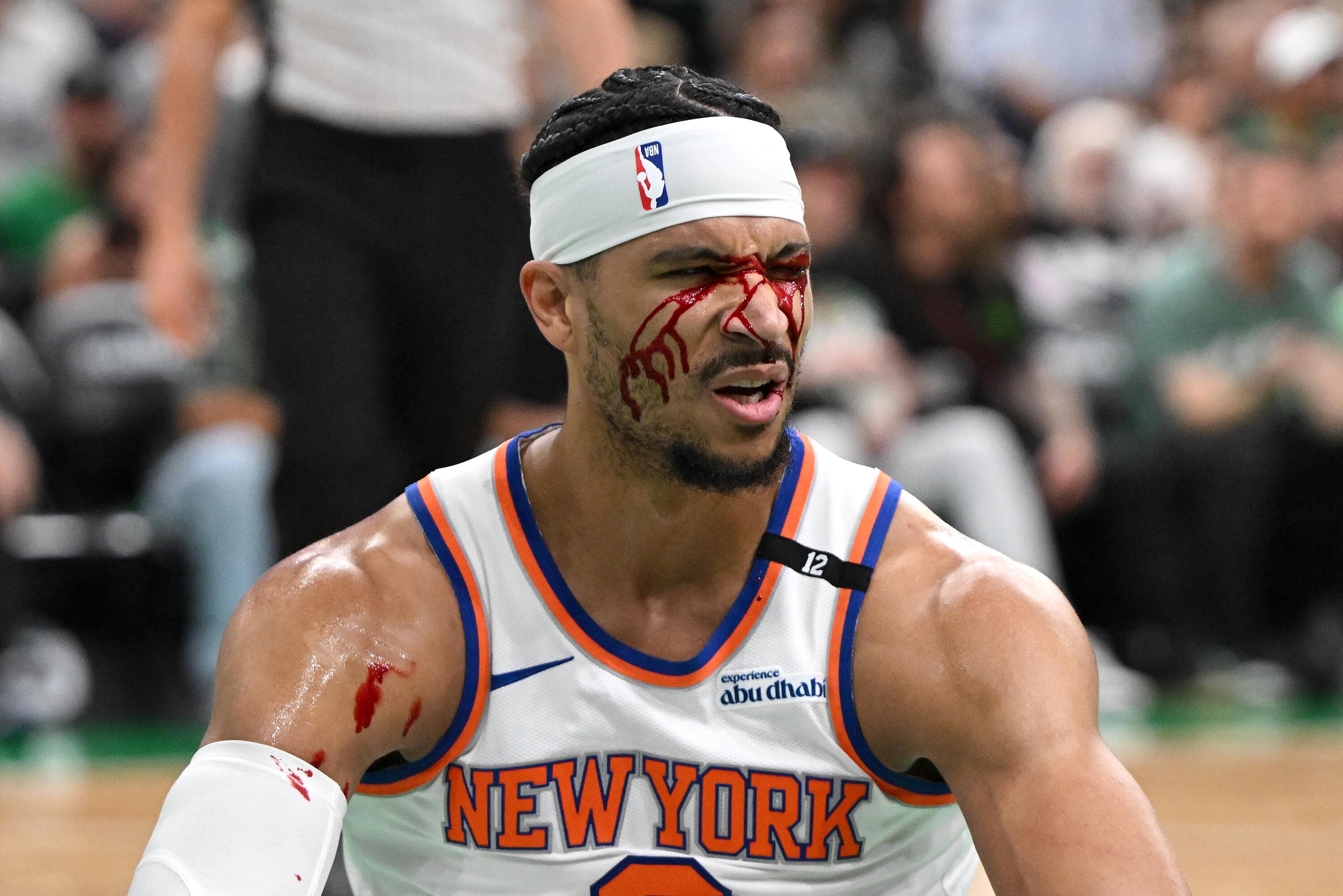 Knicks' Josh Hart Bloodied After Elbow to Face from Celtics' Luke Kornet in G5 Photo