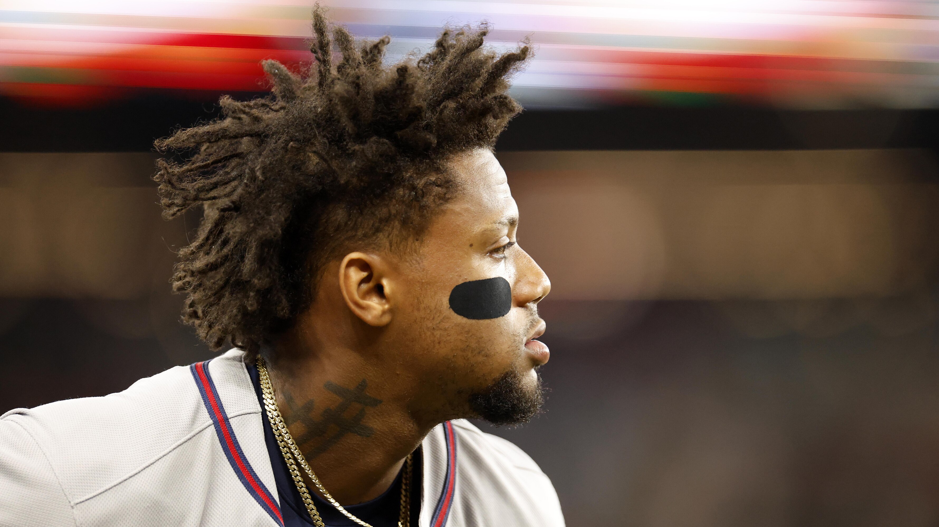 Ronald Acuna Jr. Diagnosed with Calf Injury After Exiting Braves' Loss ...